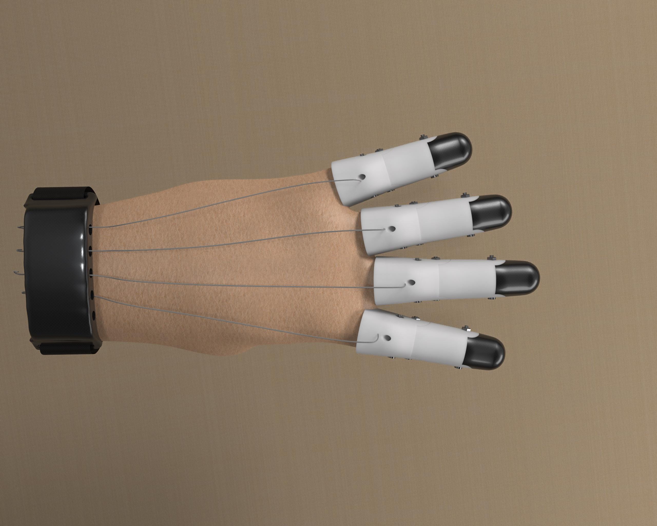 3D Print Full Hand Prosthetic STL File: DIY Finger Replacements ...