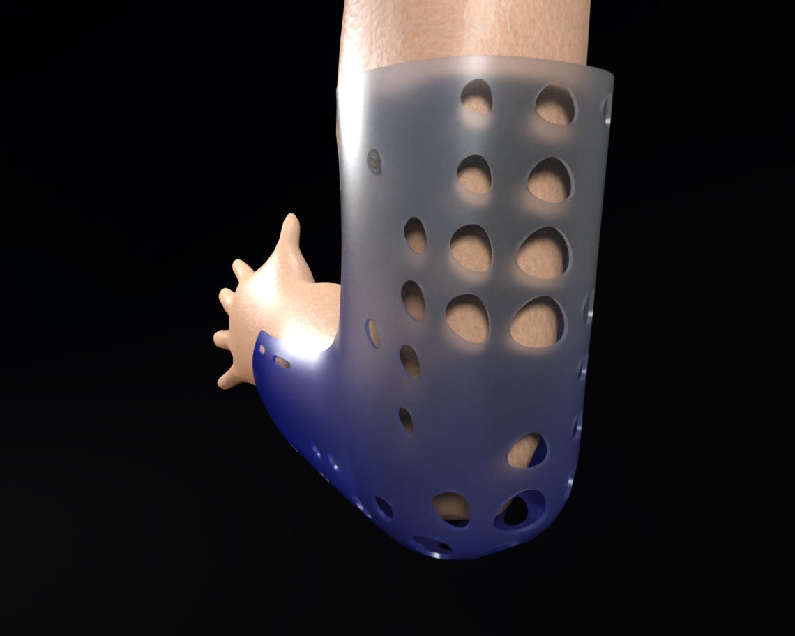 Elbow Textured Splint, 90 Degrees Firm Position, STL FILE, DIY, Print ...