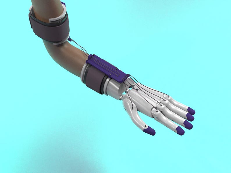 Prosthetic Forearm With Elbow-controlled Hand | STL Files Only ...