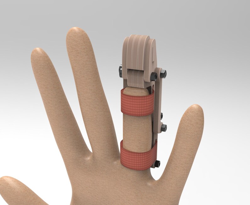 Laser-cut MDF Finger Prosthetic DXF File: DIY Fingertip Replacement ...
