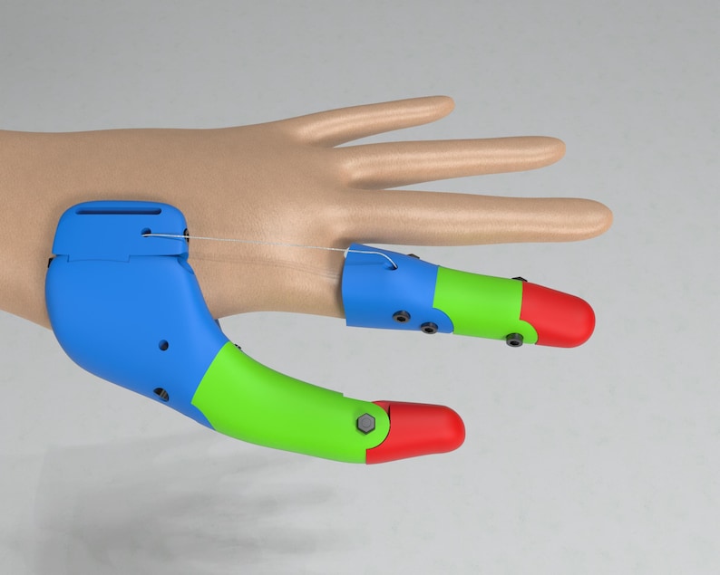 Children’s Adjustable Mechanical Finger Prosthesis STL - 3D Print File ...