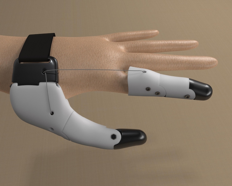 3D Print Full Hand Prosthetic STL File: DIY Finger Replacements ...