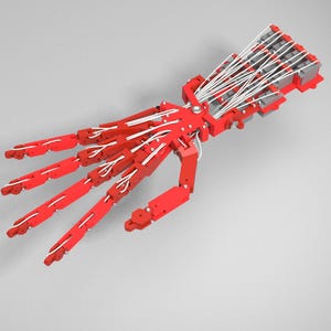 Robotic Prosthesis With Forearm Servo-controlled Finger and Wrist ...