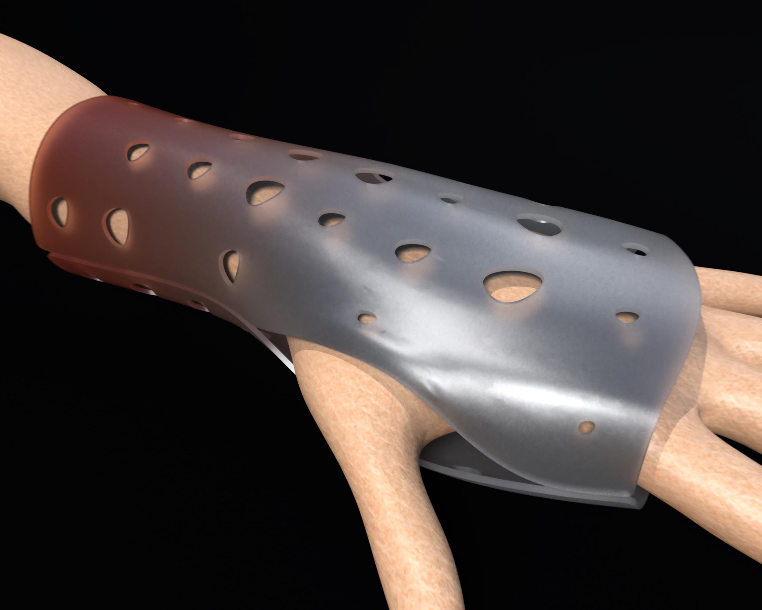 3D Printed Wrist Splint STL File: Adjustable Carpal Tunnel Brace ...