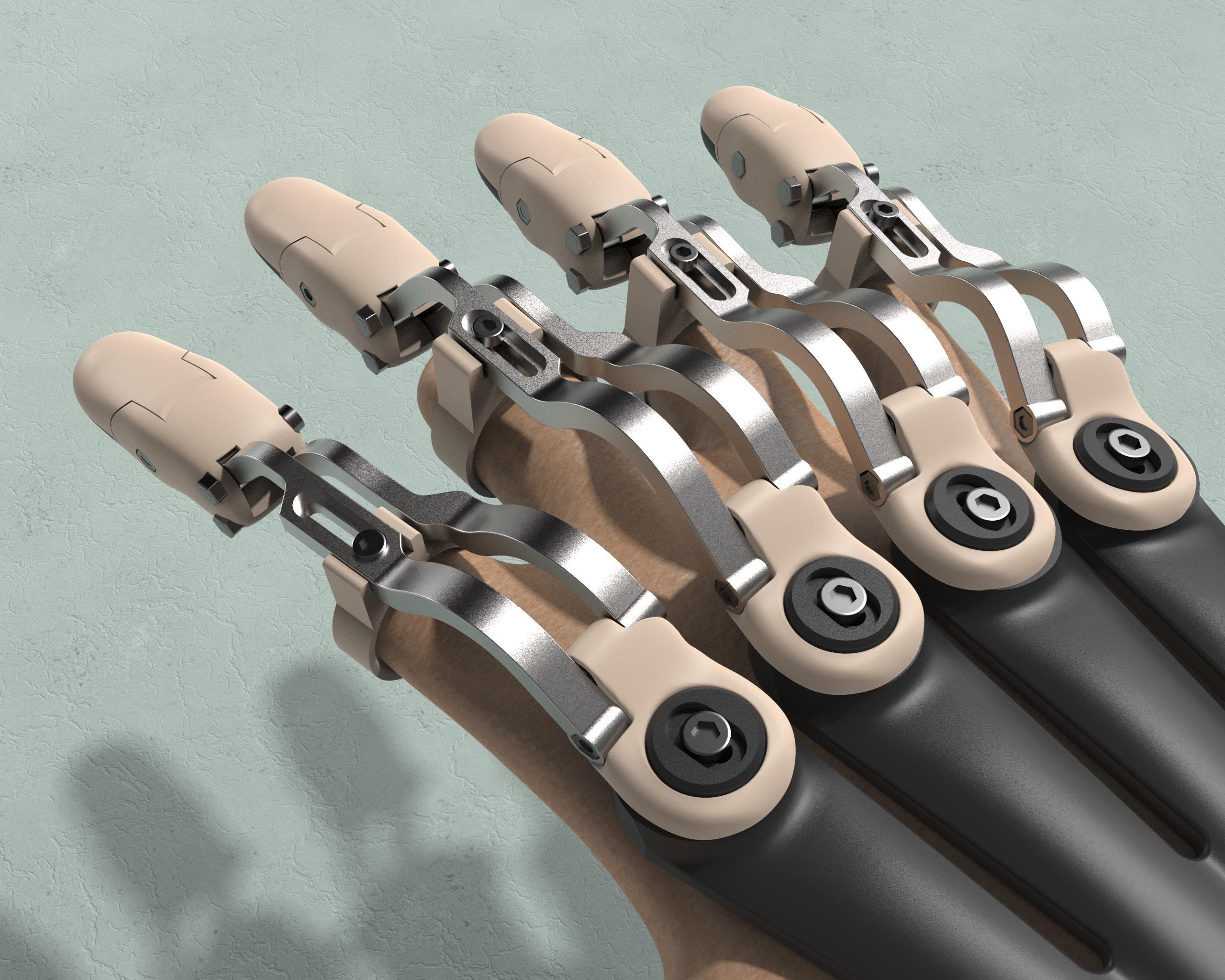 3D Printed Mechanical Prosthetic Hand STL File: DIY Assistive Device ...