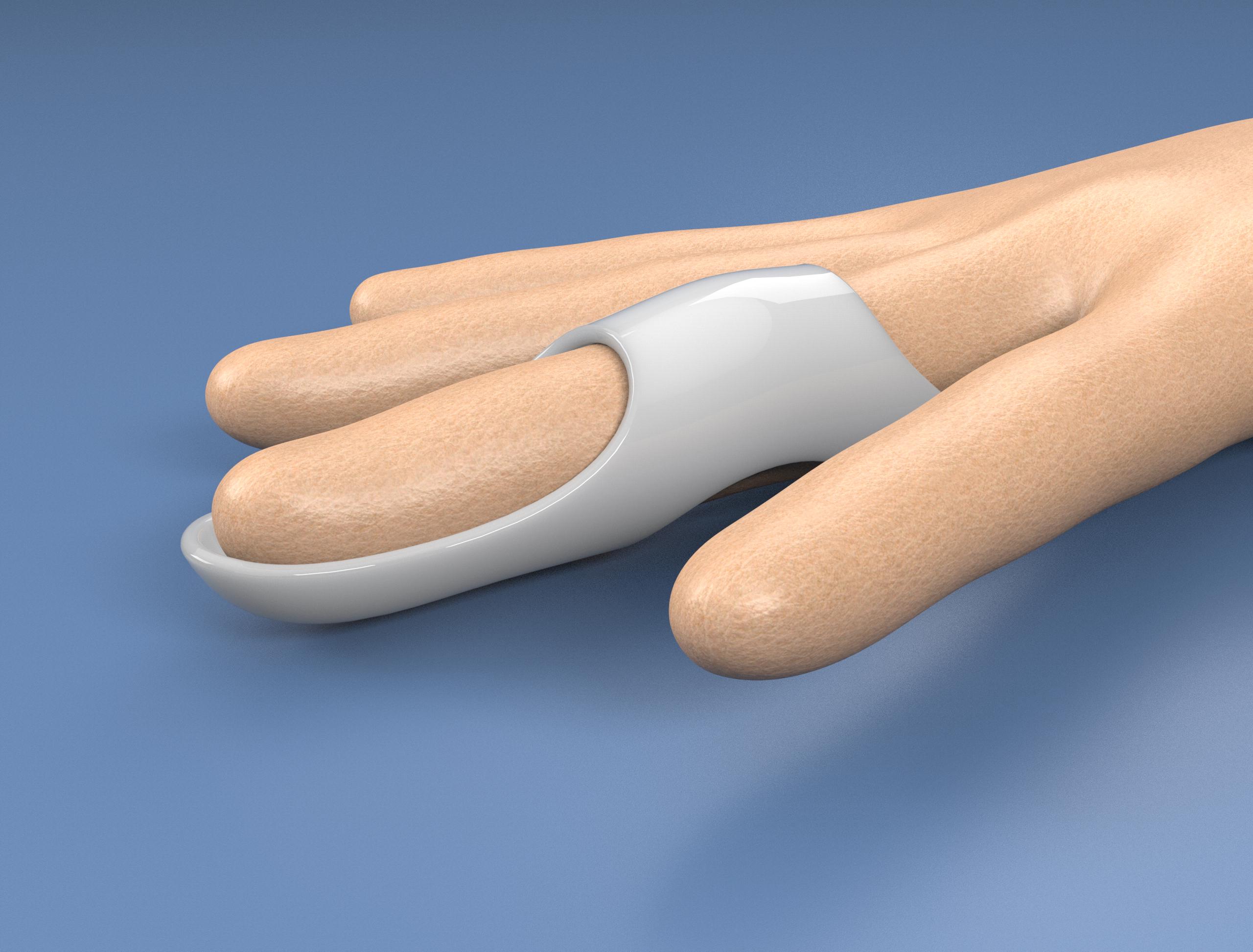 3D Finger Splint STL - Textured Brace Design for DIY Projects ...