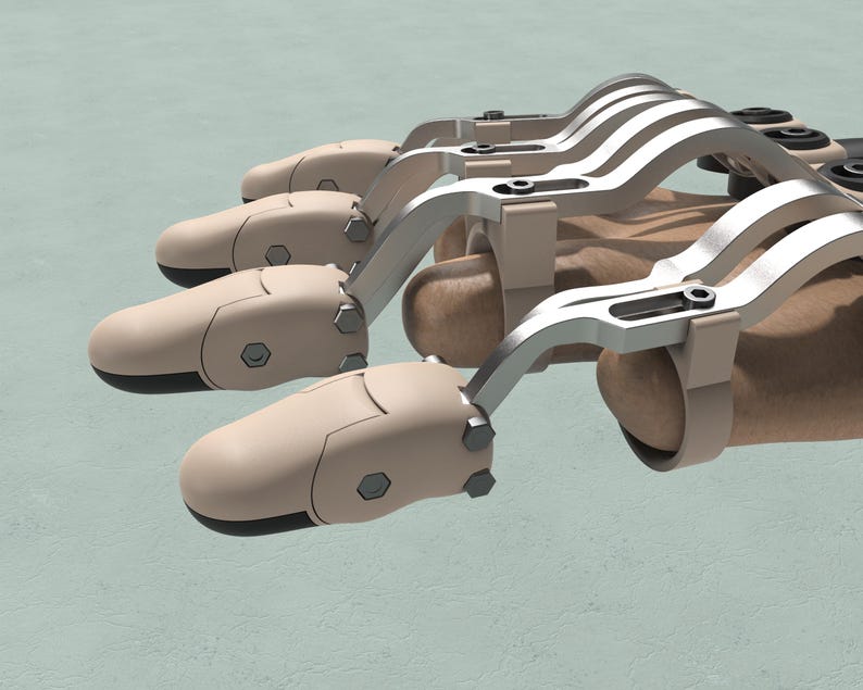 3D Printed Mechanical Prosthetic Hand STL File: DIY Assistive Device ...