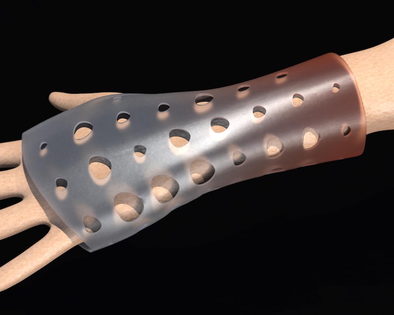 3D Printed Wrist Splint STL File: Adjustable Carpal Tunnel Brace ...