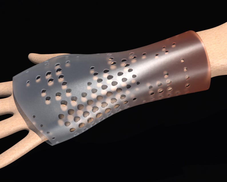 3D Printed Wrist Splint STL File: Adjustable Carpal Tunnel Brace ...
