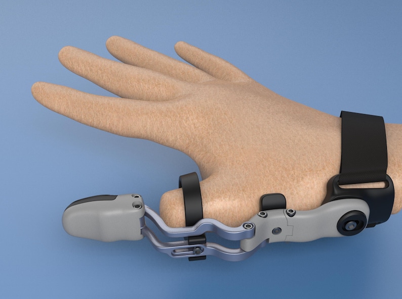 Mechanical Thumb Prosthesis STL: Custom 3D Print File (digital File) - Etsy