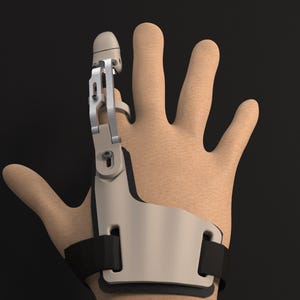 3D Printable Prosthetic Hand STL File: DIY Assistive Device (digital ...