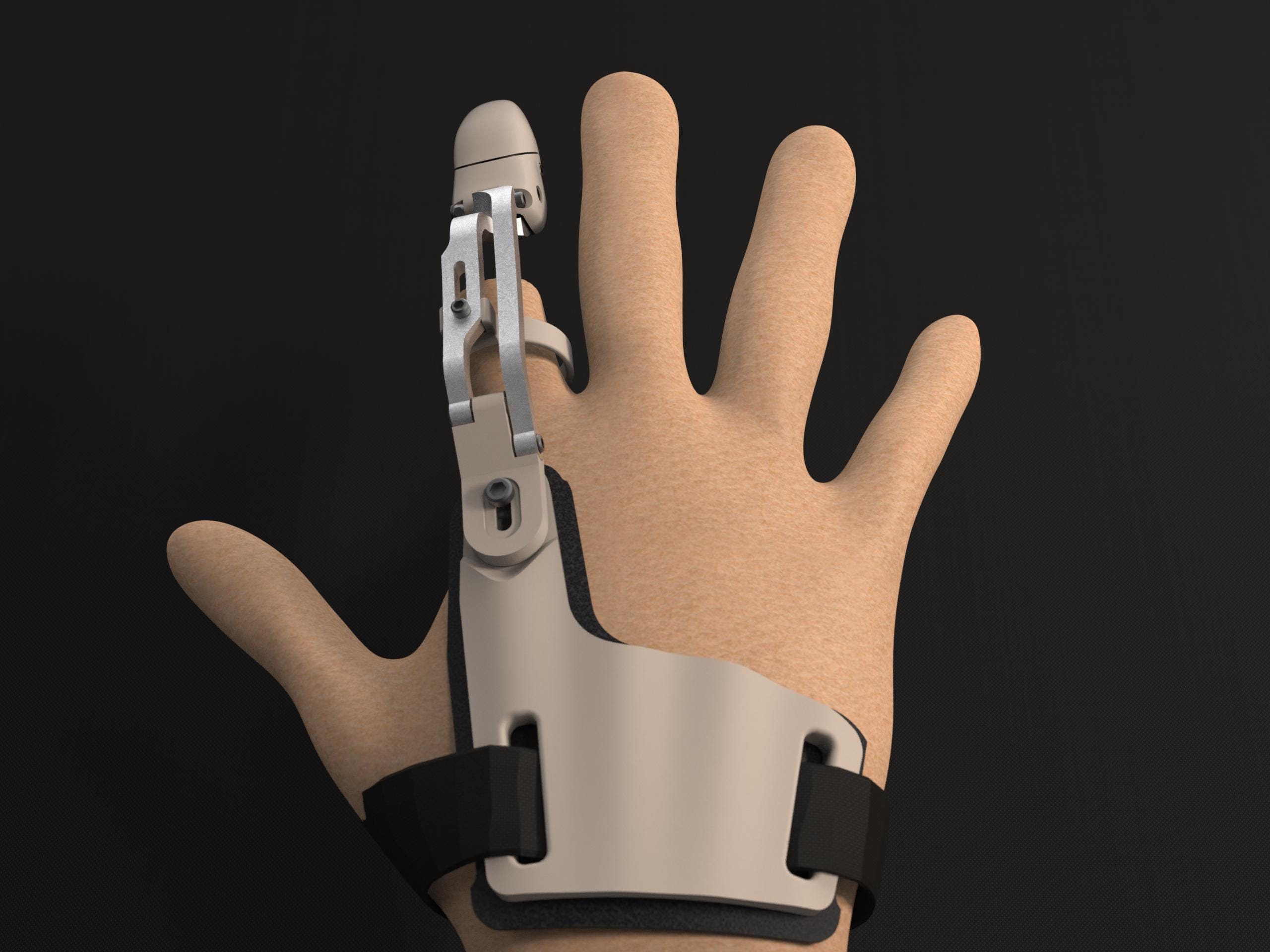 3D Printable Prosthetic Hand STL File: DIY Assistive Device (digital ...