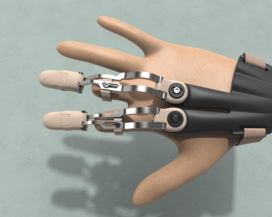 3D Printed Mechanical Prosthetic Hand STL File: DIY Assistive Device ...