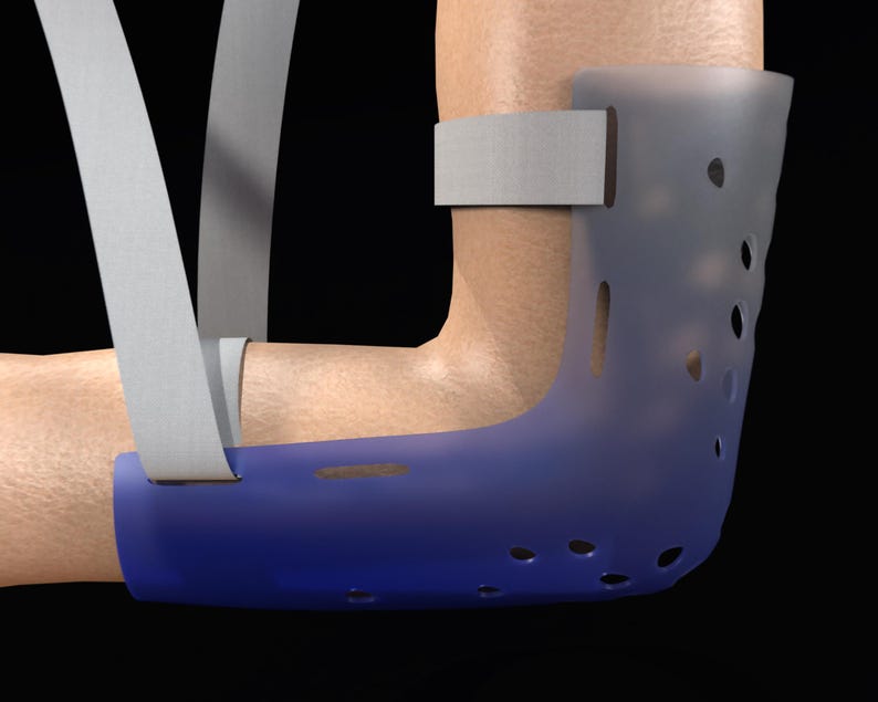 Elbow Textured Splint, 90 Degrees Firm Position, STL FILE, DIY, Print ...
