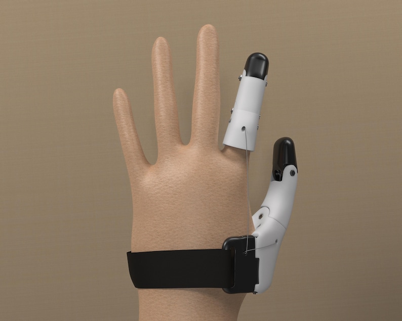 3D Print Full Hand Prosthetic STL File: DIY Finger Replacements ...