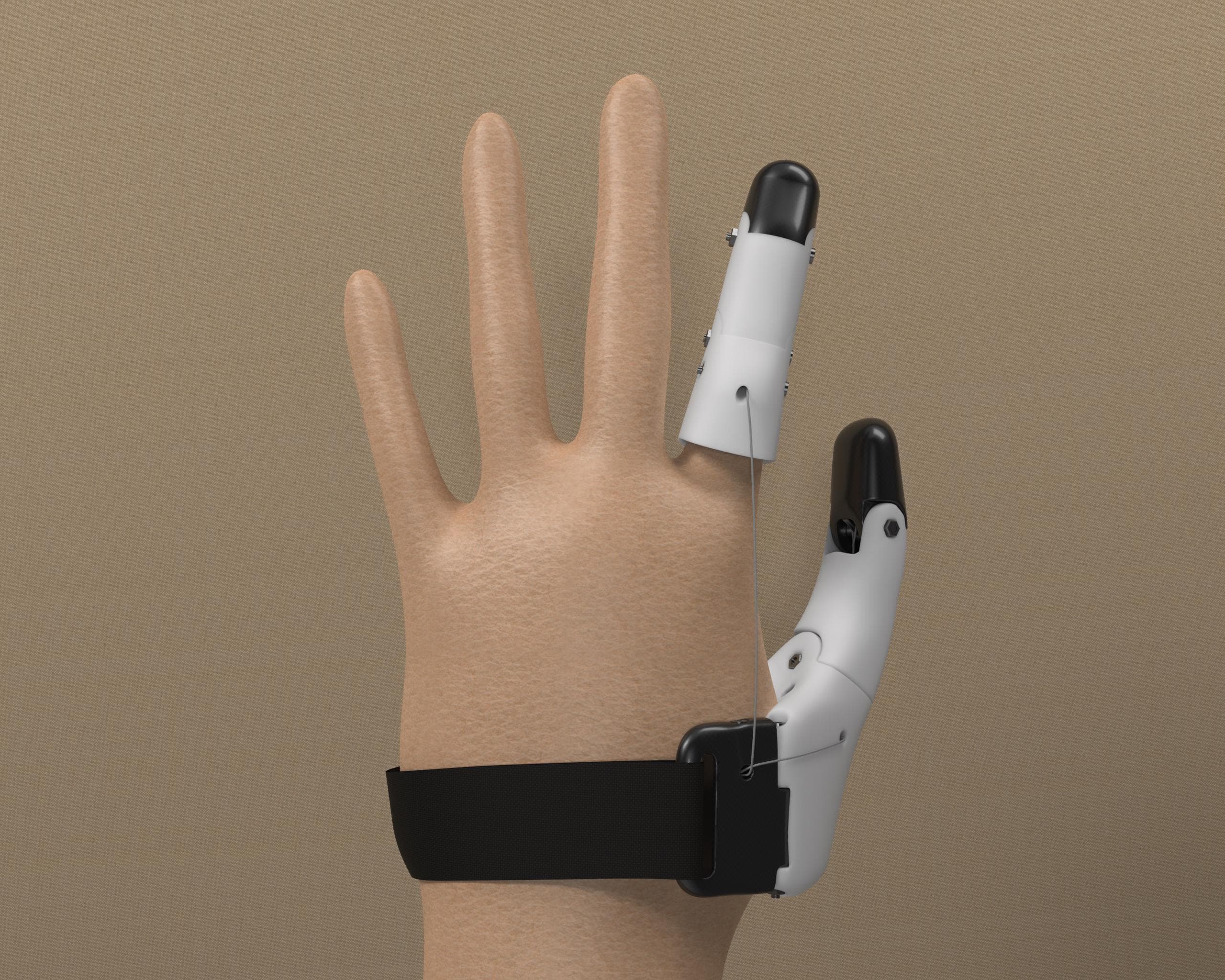 3D Print Full Hand Prosthetic STL File: DIY Finger Replacements ...
