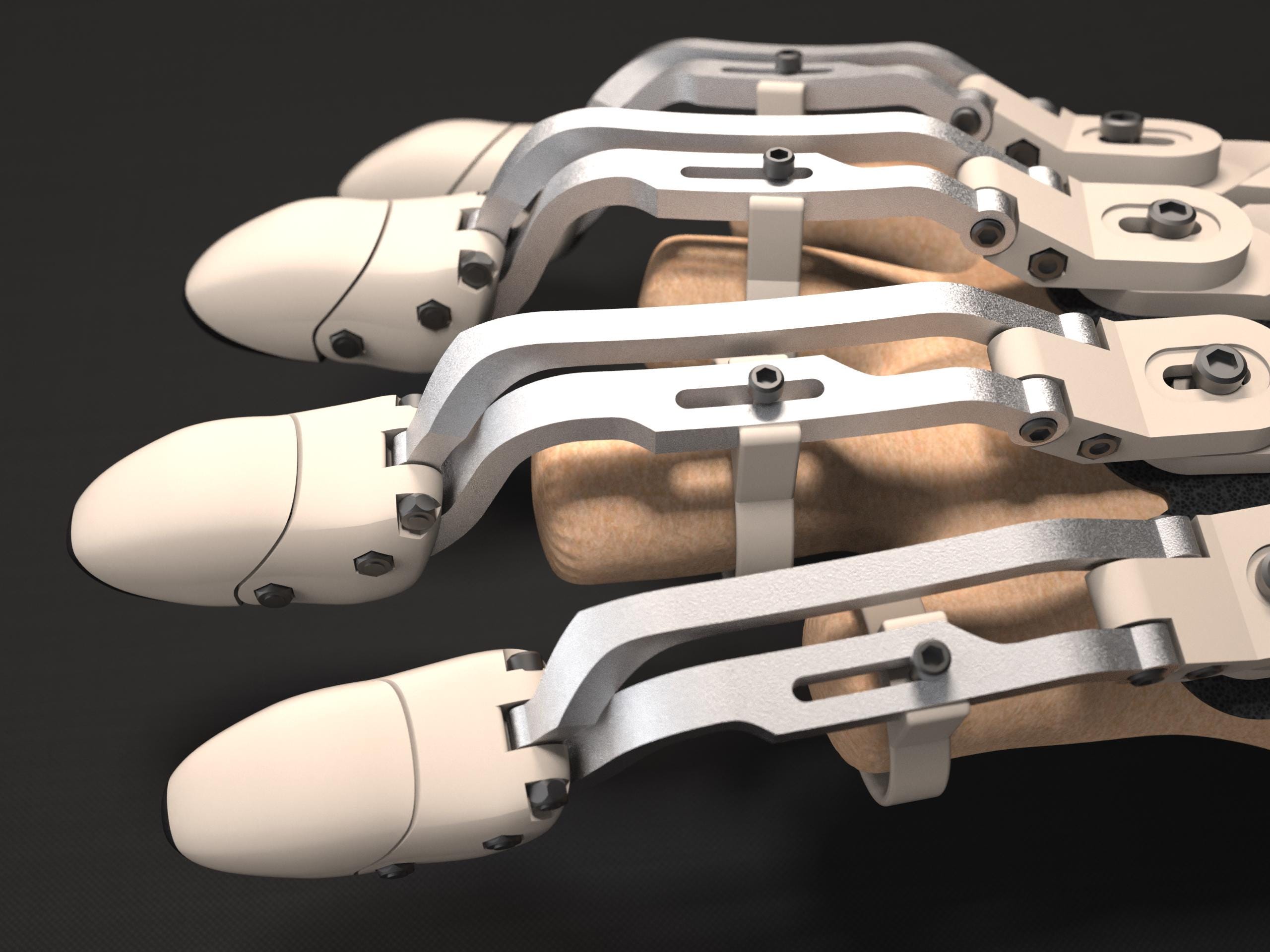 3D Printable Prosthetic Hand STL File: DIY Assistive Device (digital ...