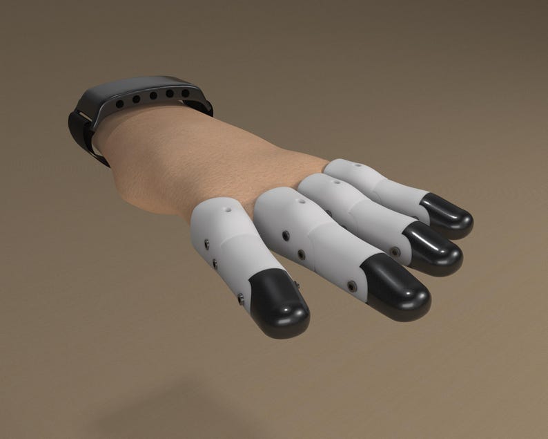 3D Print Full Hand Prosthetic STL File: DIY Finger Replacements ...