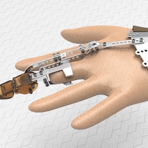 Adjustable Laser Cut Metal Hand Prosthesis With 3d-printed Finger ...