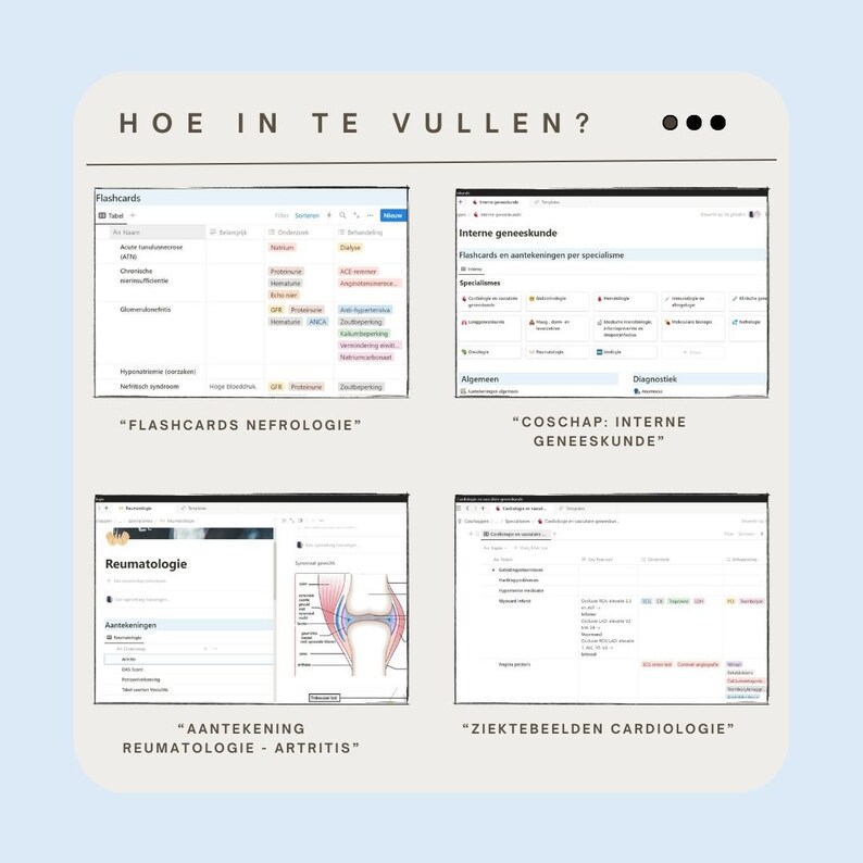 Notion Template Internships - Etsy