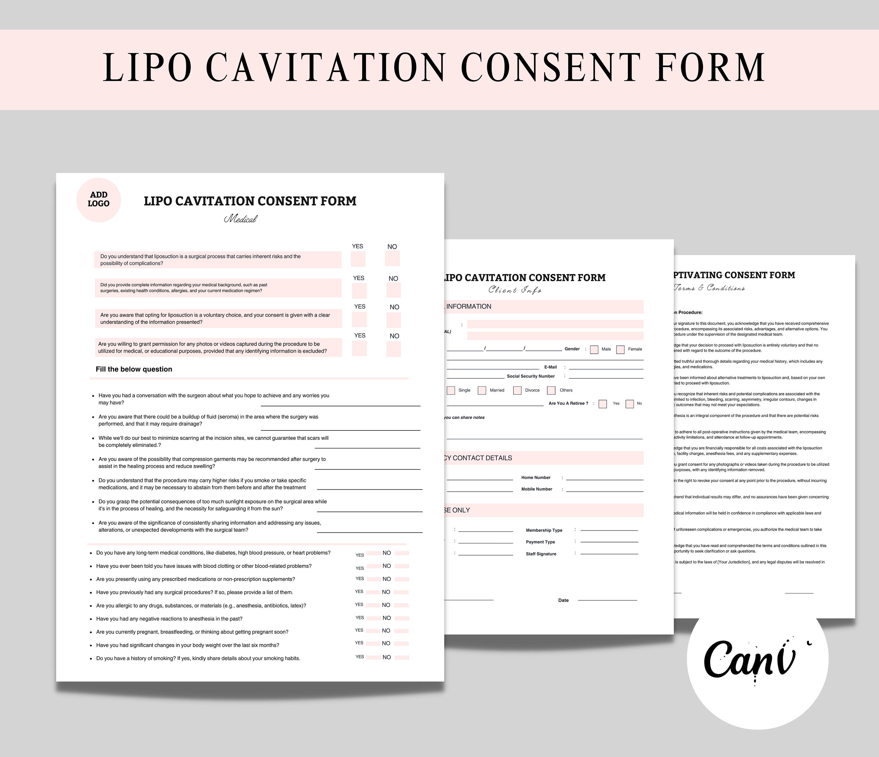 Lipo Cavitative Consent Form Guide, Editable Templates, Lipo Cavitation ...