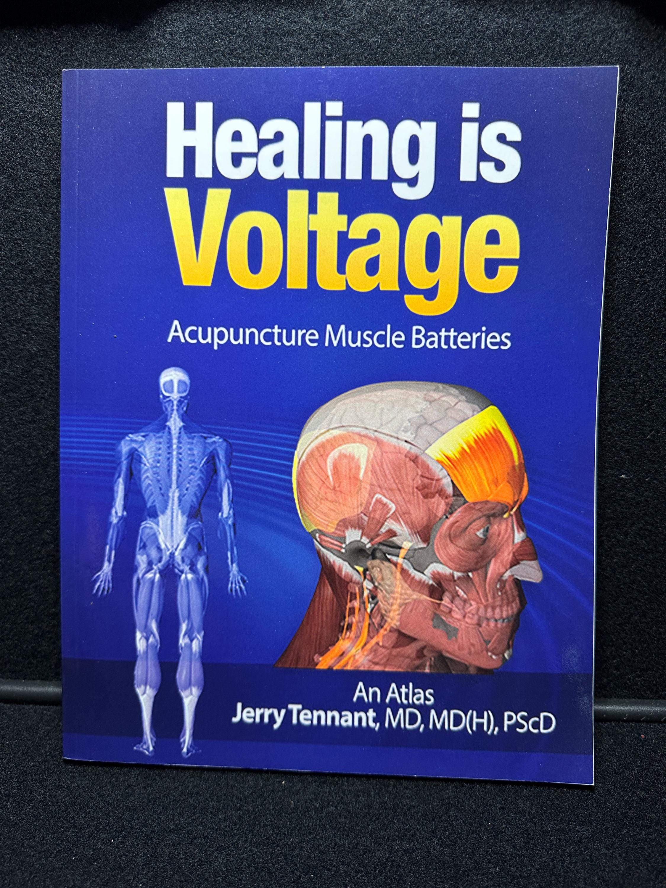 Healing is Voltage: Acupuncture Muscle Batteries by Tennant - Etsy