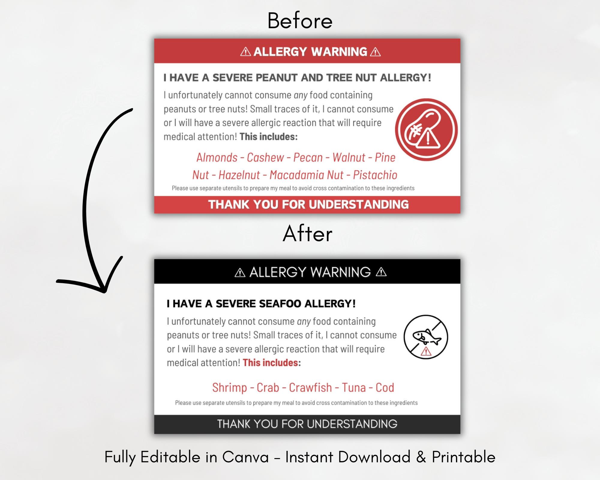 Printable Fully Editable Tree Nut Allergy Medical Warning Card, Food ...