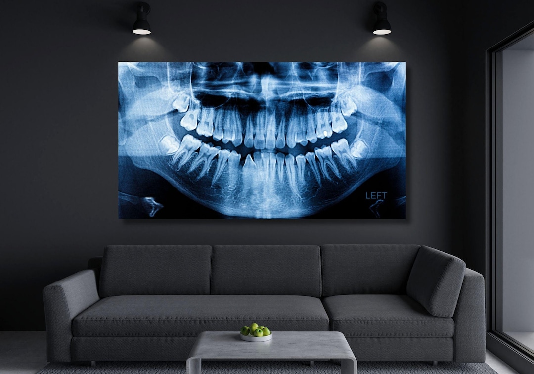 Dental Teeth Canvas Wall Art, Dental Clinic Poster, Gift for the ...
