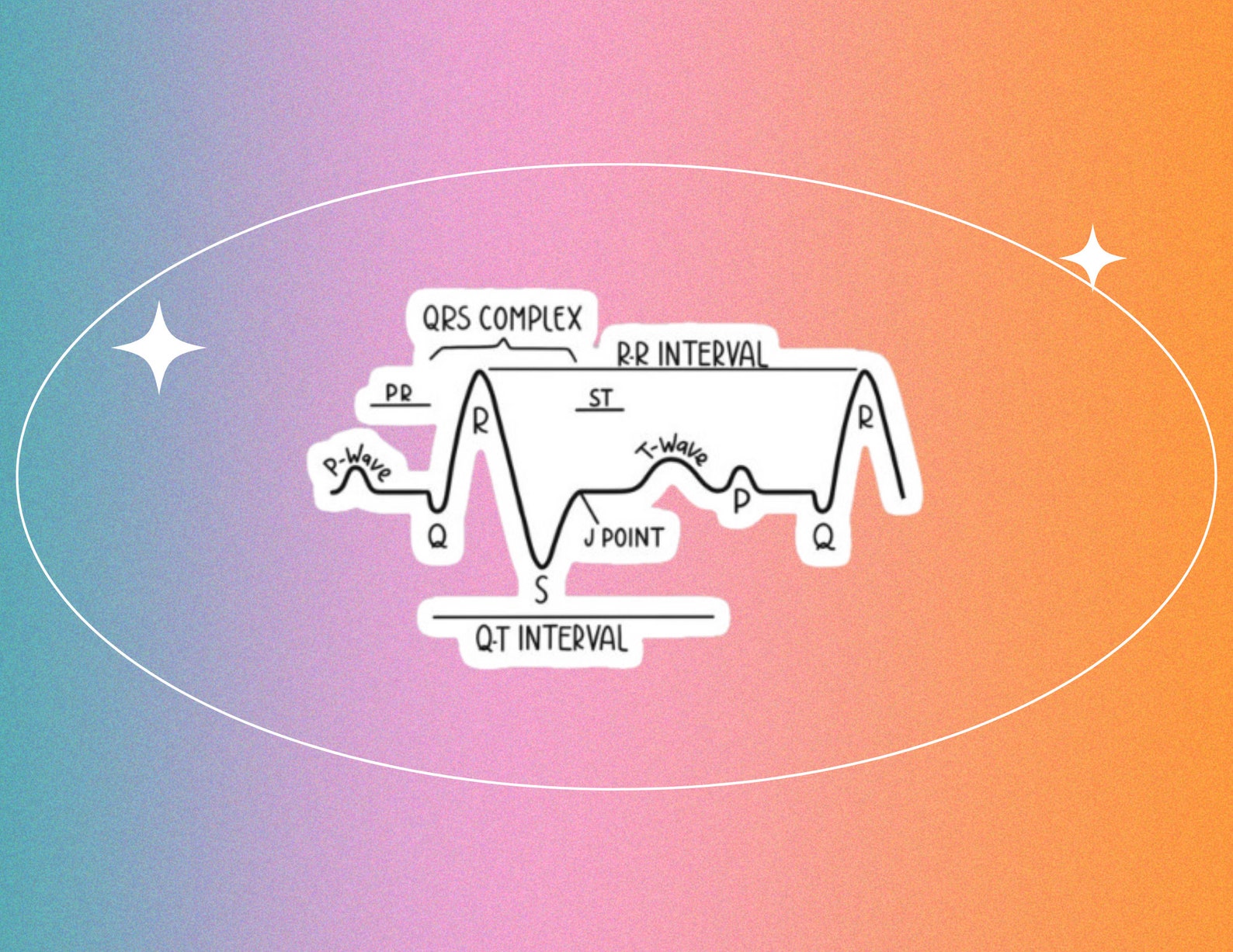 EKG Sticker Bundle: Medical Cheat Sheet, QRS Complex - Set of 3 - Etsy