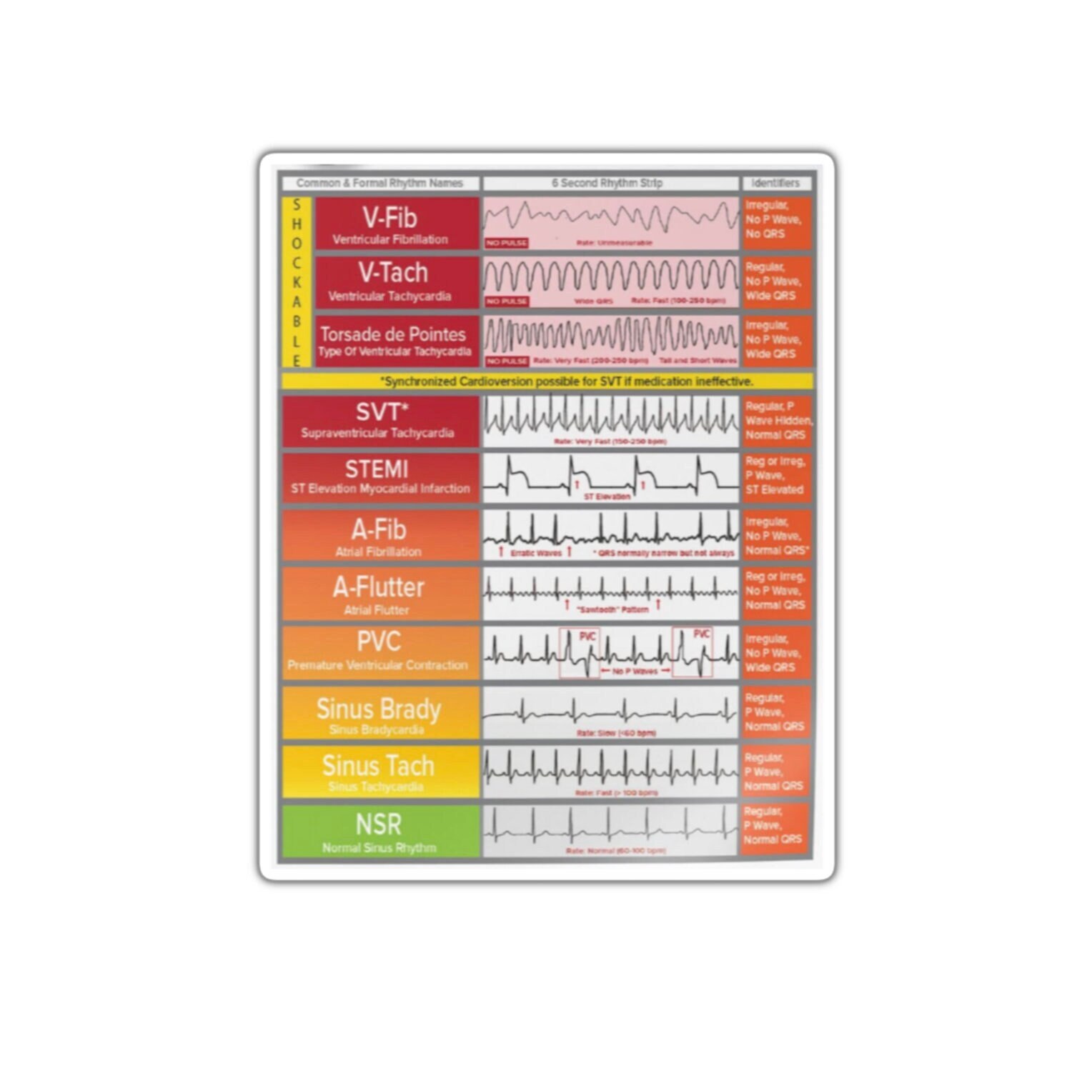 EKG Interpretation Holographic Sticker: Medical Student Cardiology Aid ...