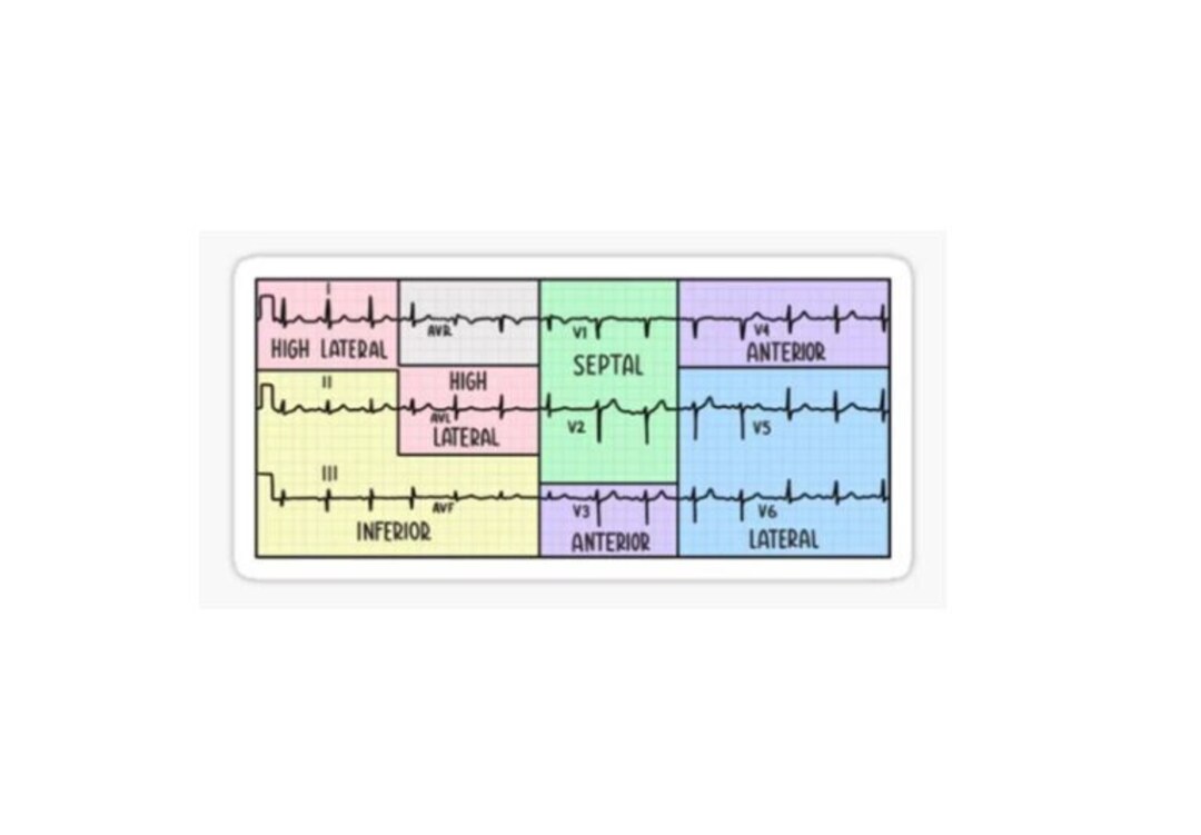 EKG Localization Holographic Sticker: Medical Student Cardiology ...