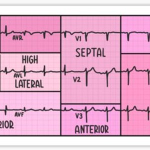 Pink EKG Localization Cardiology Sticker- Medical Student Gift, Med ...