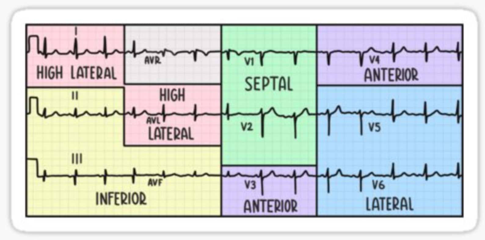 EKG Localization Holographic Sticker: Medical Student Cardiology ...