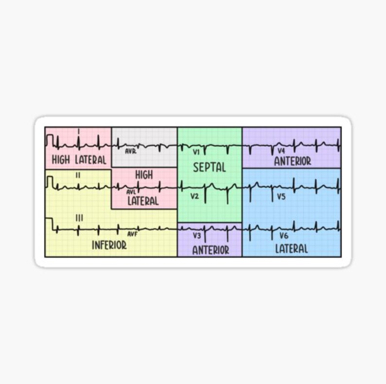 EKG Localization Holographic Sticker: Medical Student Cardiology ...