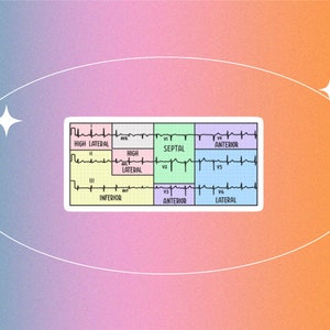 EKG Sticker Bundle: Medical Cheat Sheet, QRS Complex - Set of 3 - Etsy