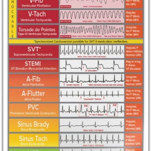 EKG Interpretation Holographic Sticker: Medical Student Cardiology Aid ...