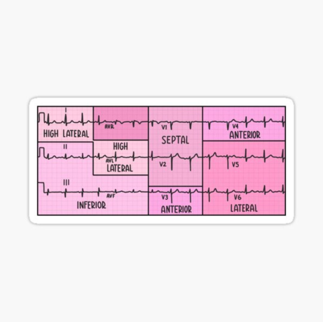 Pink EKG Localization Cardiology Sticker- Medical Student Gift, Med ...
