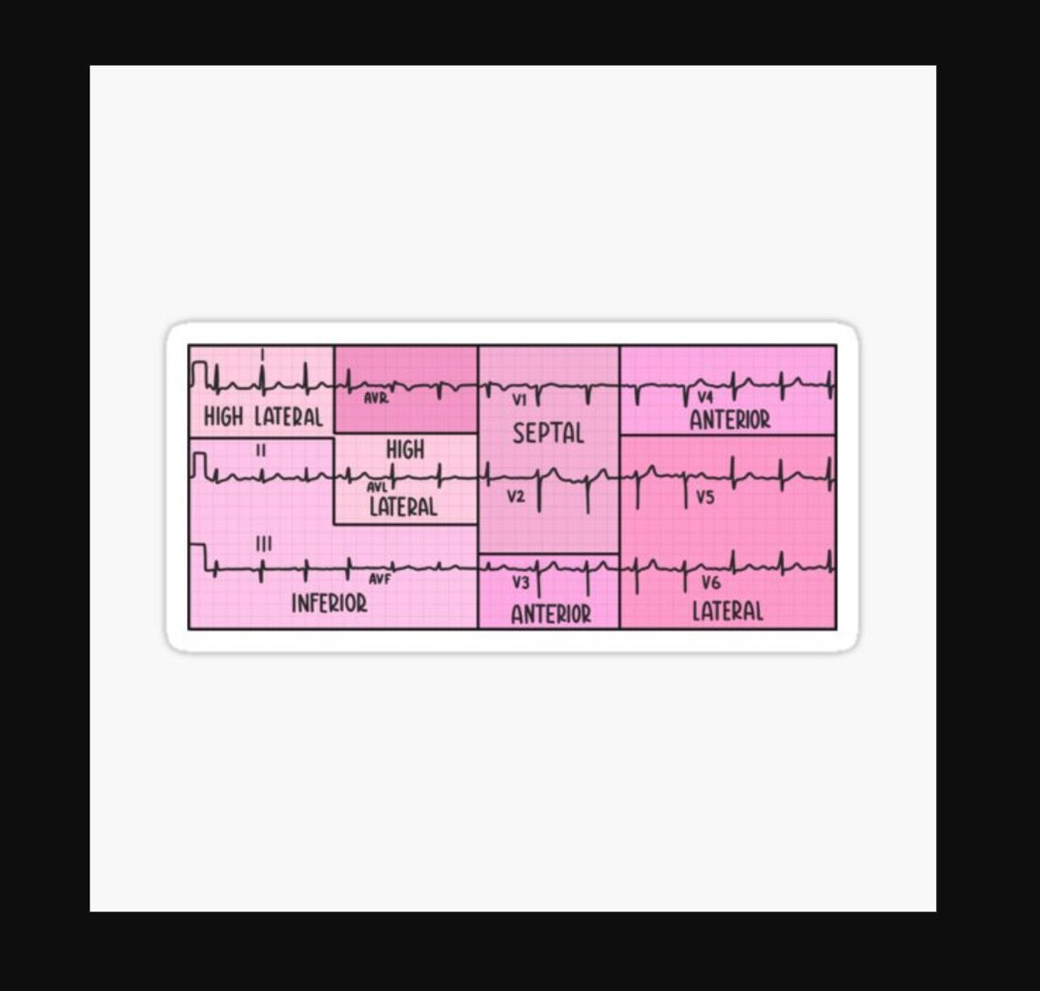 Pink EKG Localization Cardiology Sticker Medical Student Gift, Learning ...