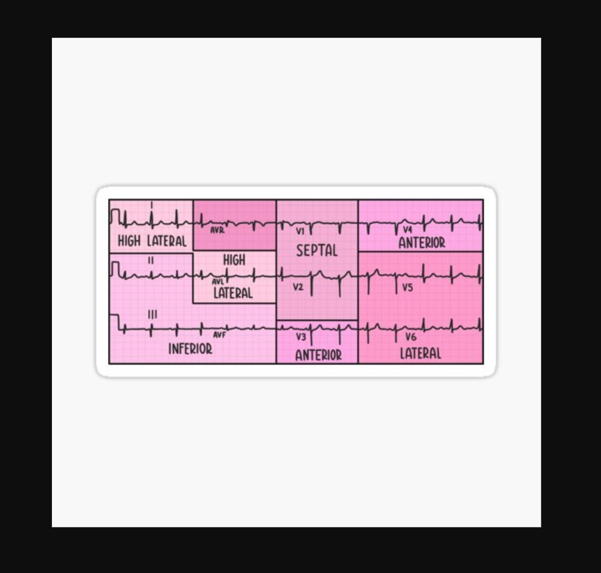 Pink EKG Localization Cardiology Sticker Medical Student Gift, Learning ...