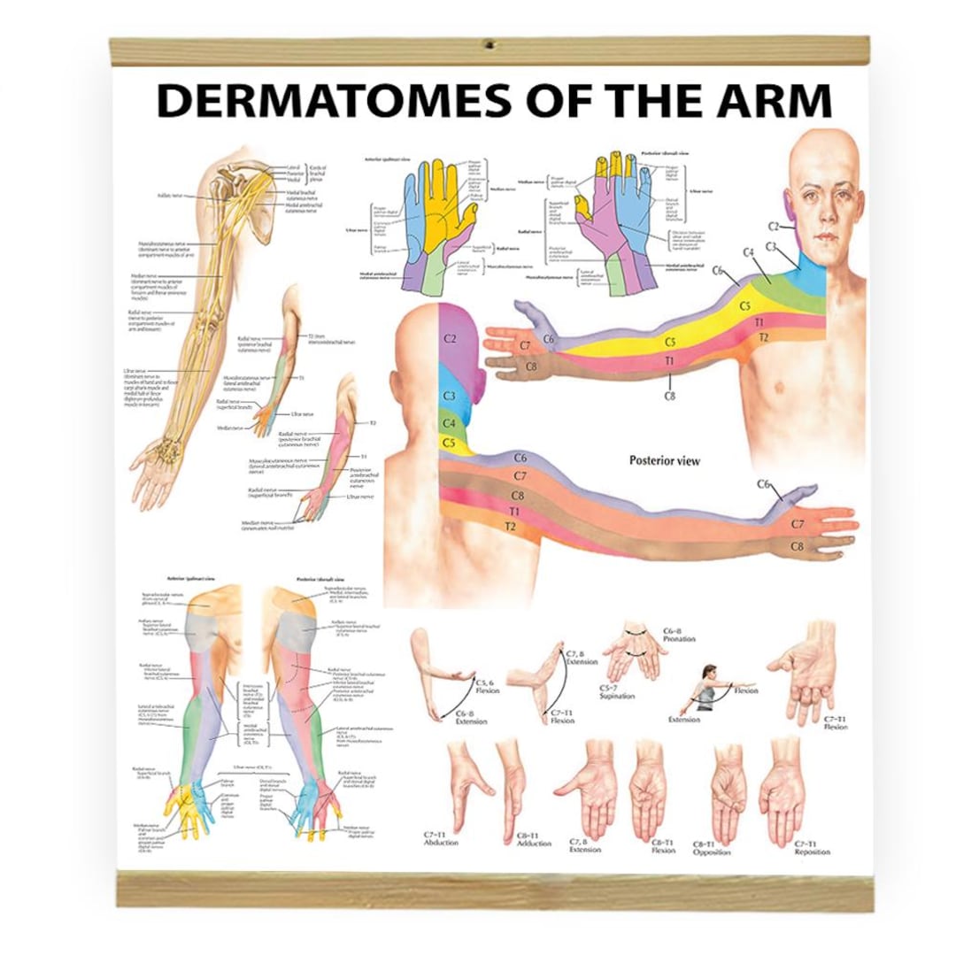Dermatomes of the Arm Poster – Nerve Map, Anatomy Art - Etsy UK