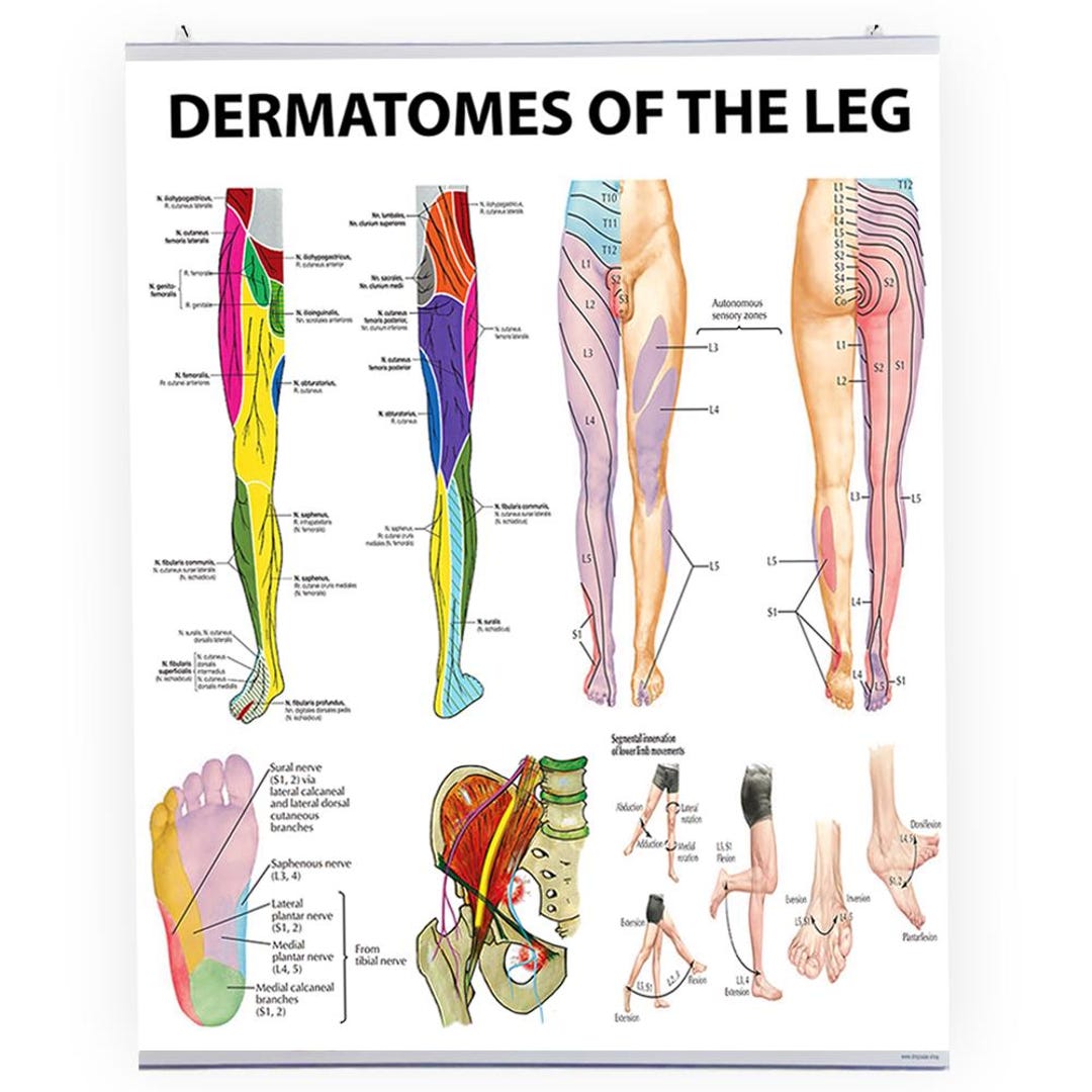 Leg Dermatomes Poster – Nerve Distribution Chart, Medical Anatomy Art ...