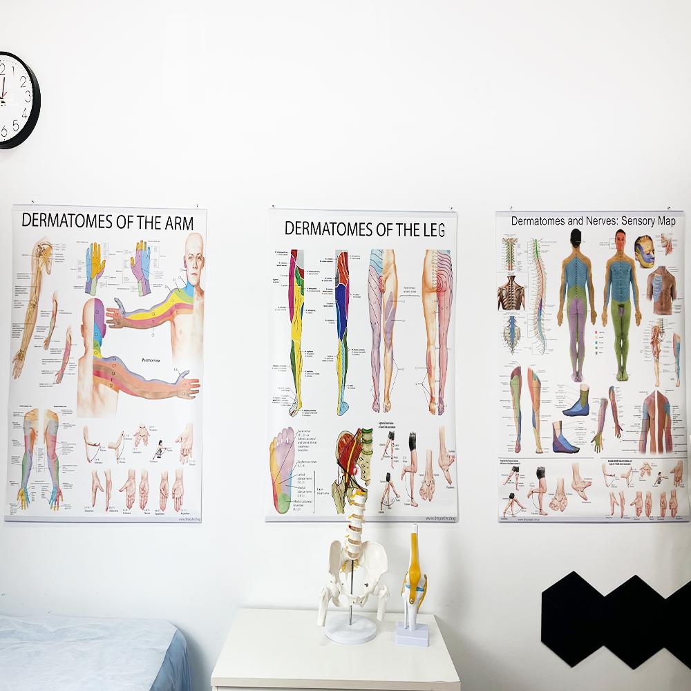 Dermatomes of the Arm Poster – Nerve Map, Anatomy Art - Etsy UK