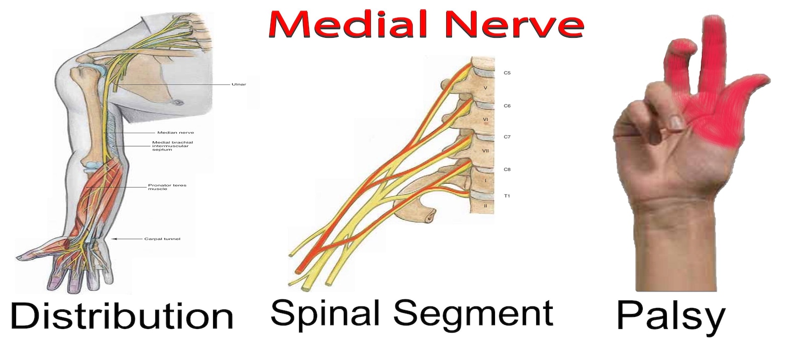 Nerves of the Arm: Distribution, Spinal Segment, and Palsy - High ...