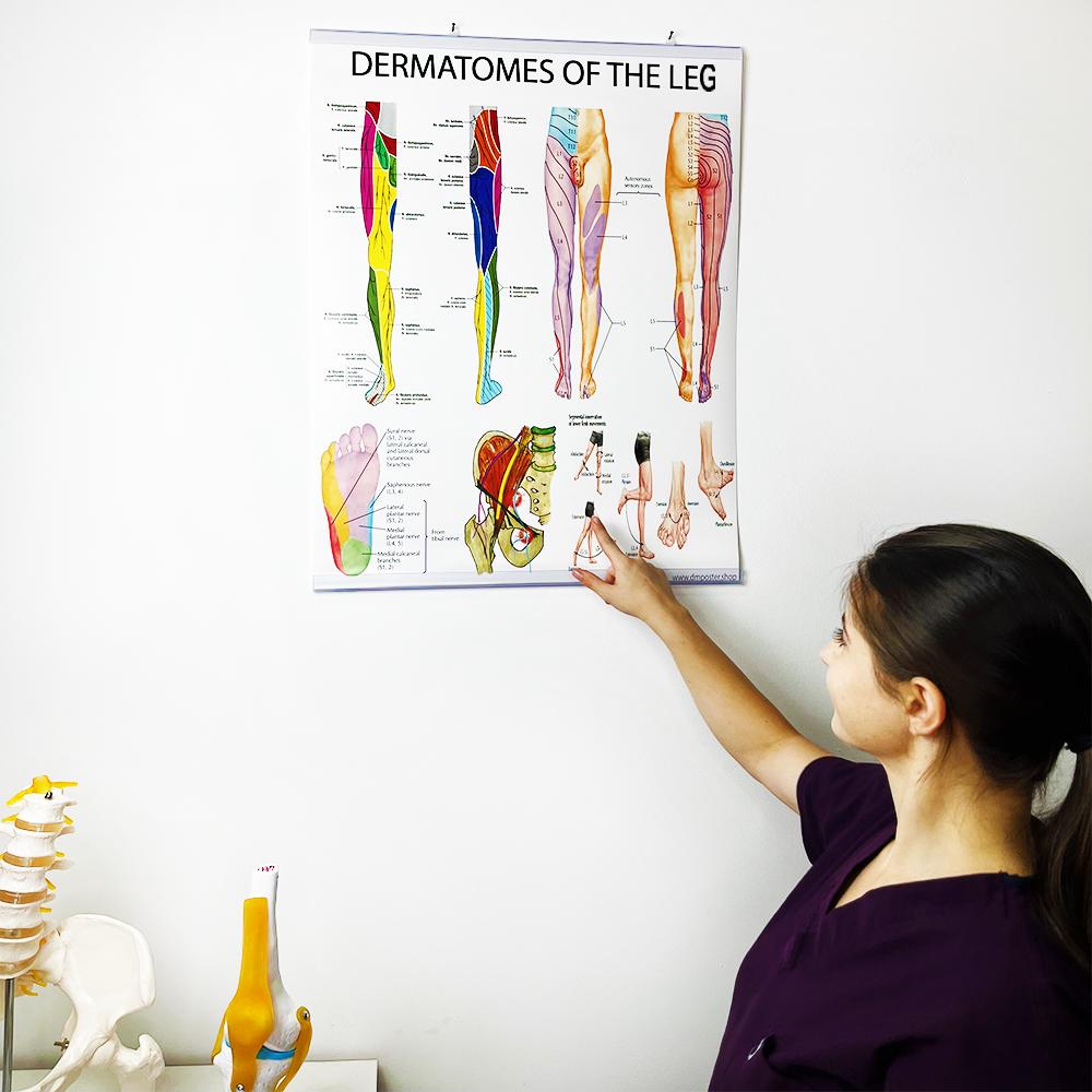 Leg Dermatomes Poster – Nerve Distribution Chart, Medical Anatomy Art ...