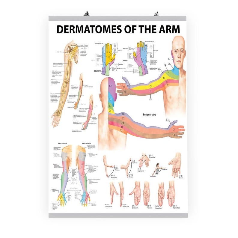 Dermatomes of the Arm Poster – Nerve Map, Anatomy Art - Etsy Australia