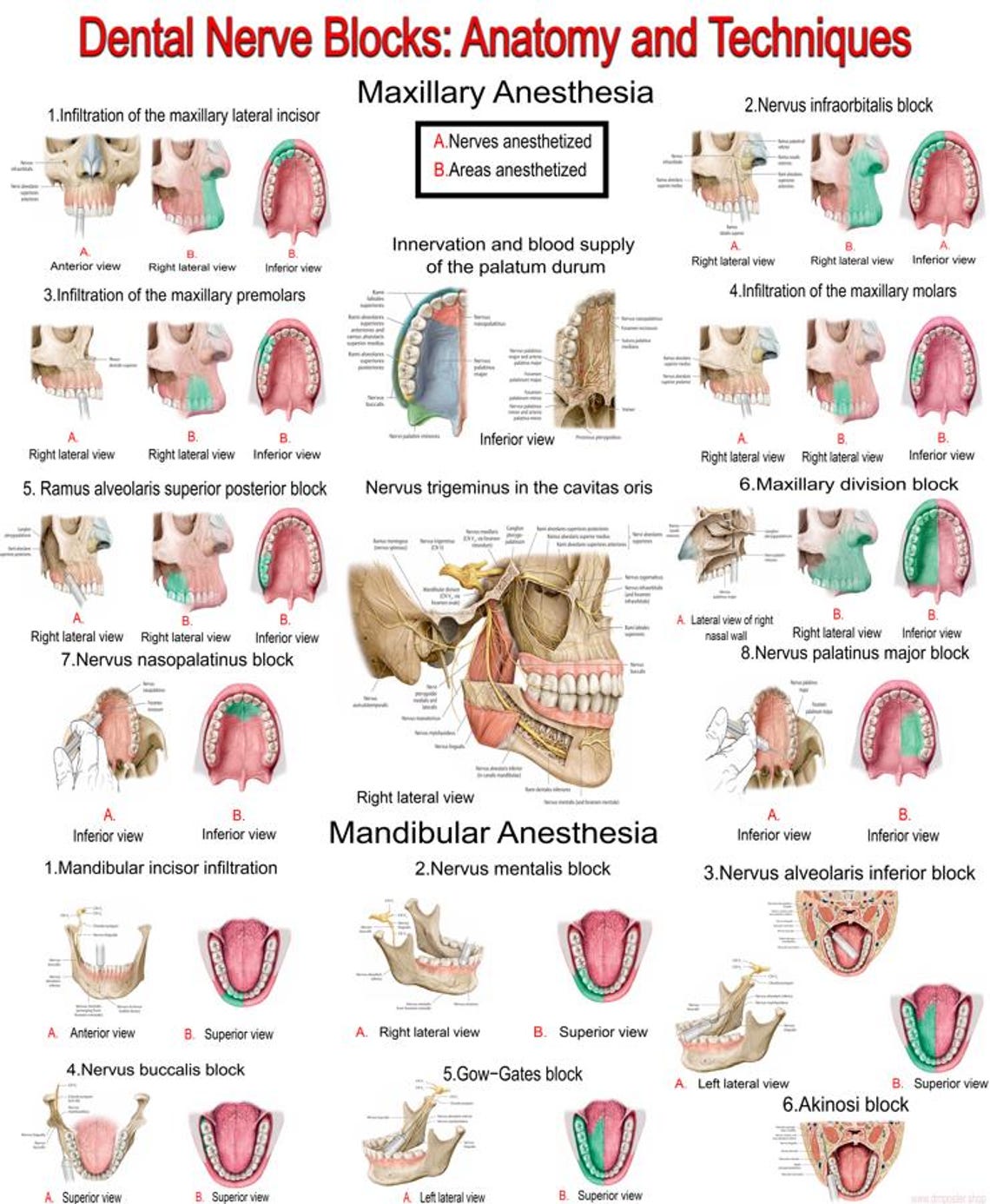 Dental Nerve Blocks: Anatomy & Techniques | High-resolution PDF | Ready ...