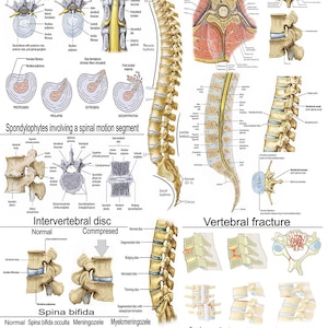 Spine Anatomy and Disorders Poster: Visual Guide (PDF) - Etsy