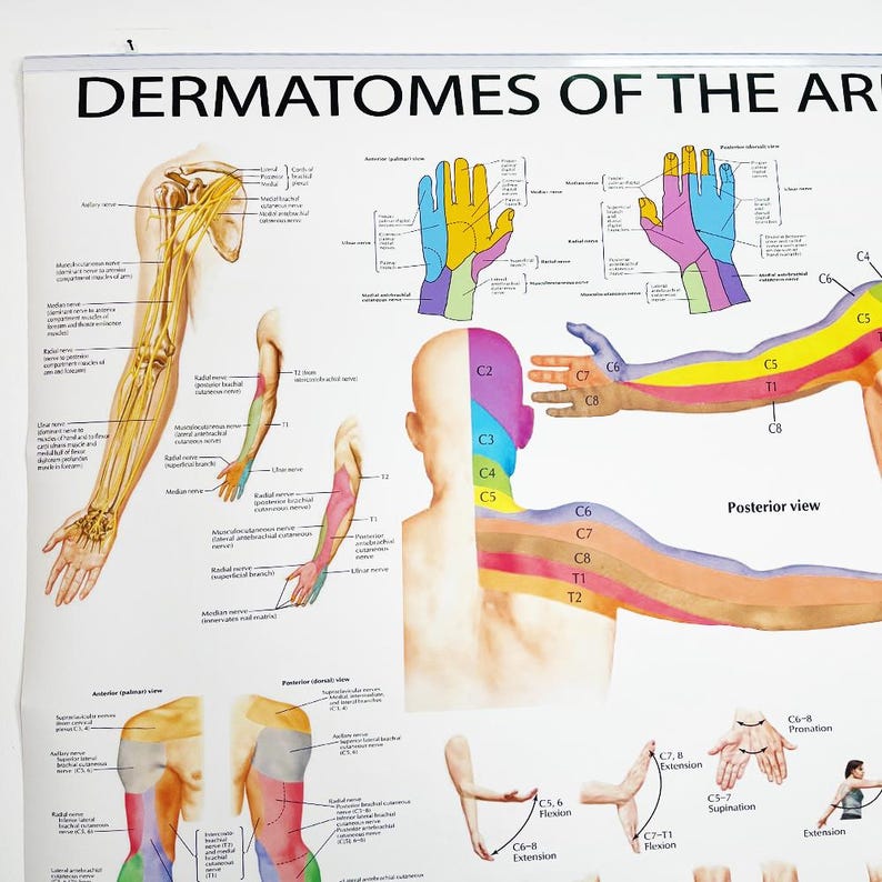 Dermatomes of the Arm Poster – Nerve Map, Anatomy Art - Etsy Australia