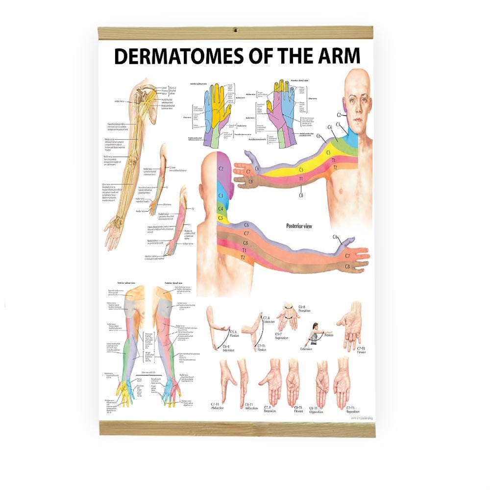 Dermatomes of the Arm Poster – Nerve Map, Anatomy Art - Etsy UK