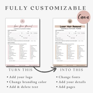 Laser Consultation, Laser Hair Reduction, Fitzpatrick Scale, Laser Hair ...